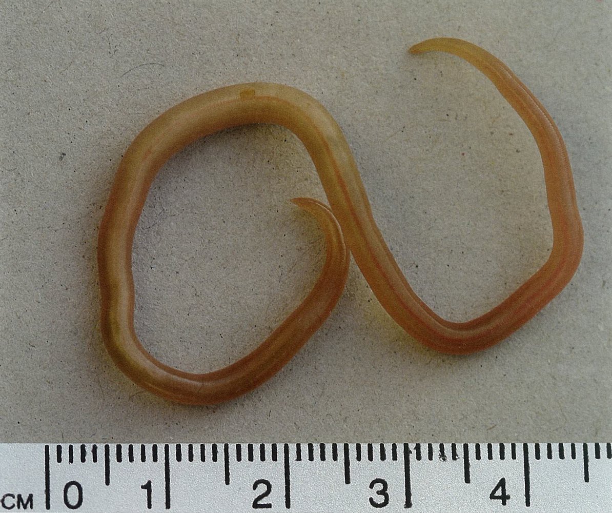 Ascaris Lumbricoides Worm