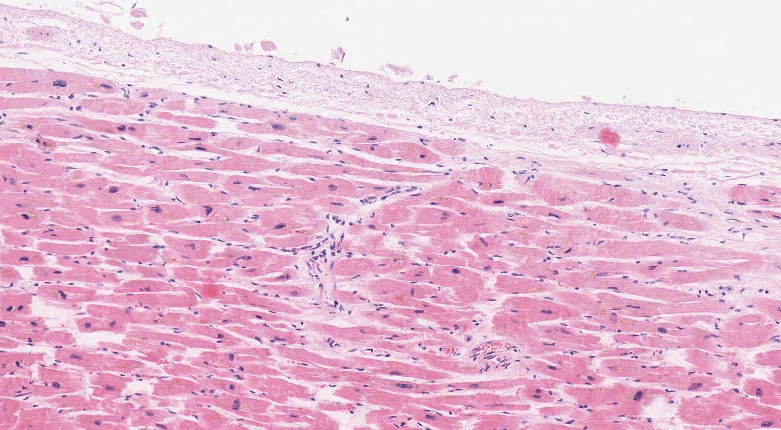Smooth Muscle Fiber Microscope