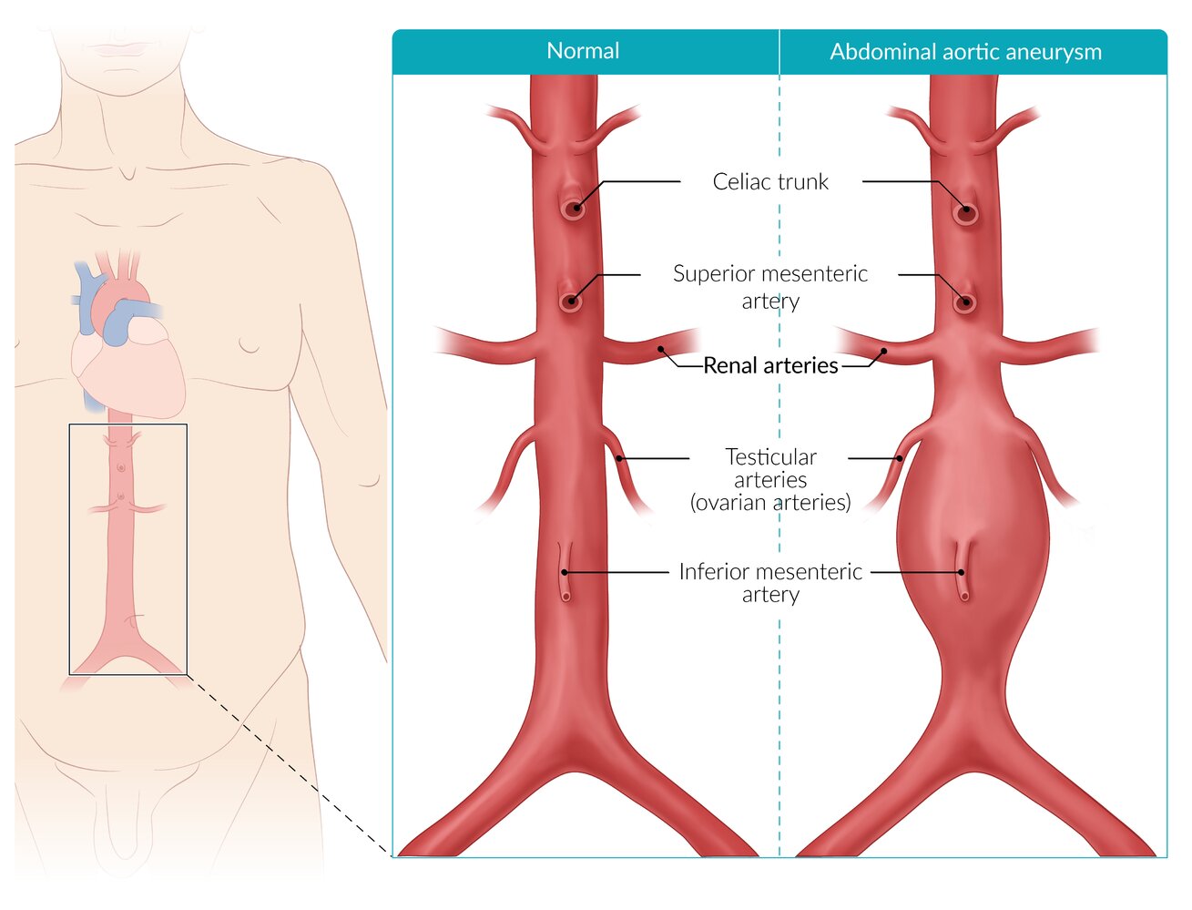 Stomach Aorta