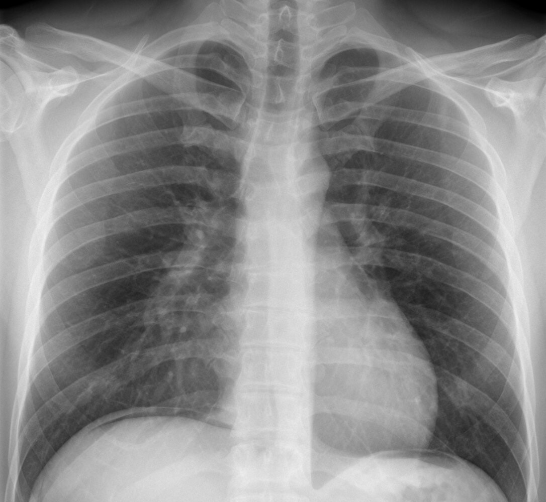 CHEST X RAY Jeopardy Template