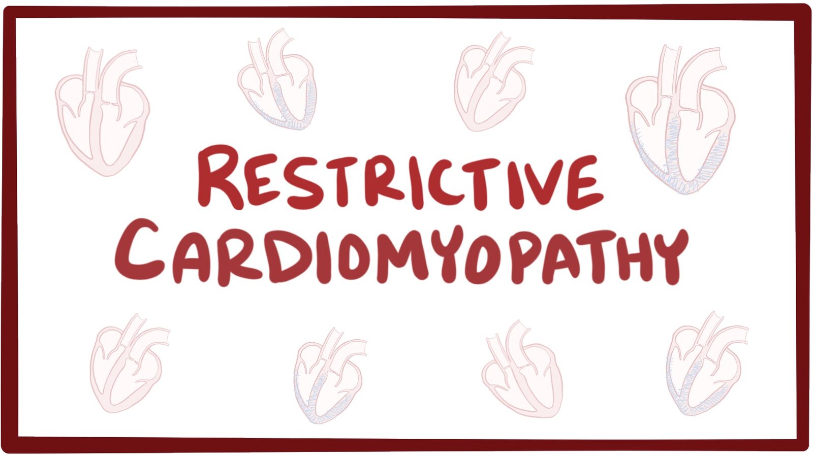 Restrictive Cardiomyopathy