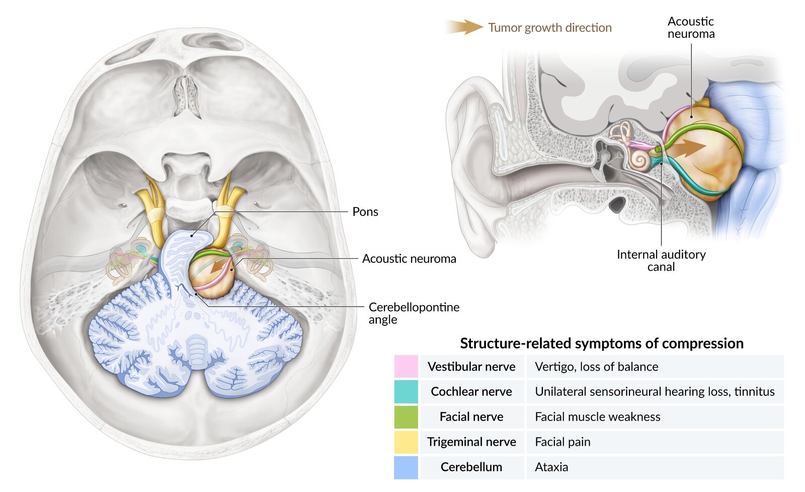 Cerebellopontine Angle Nerves