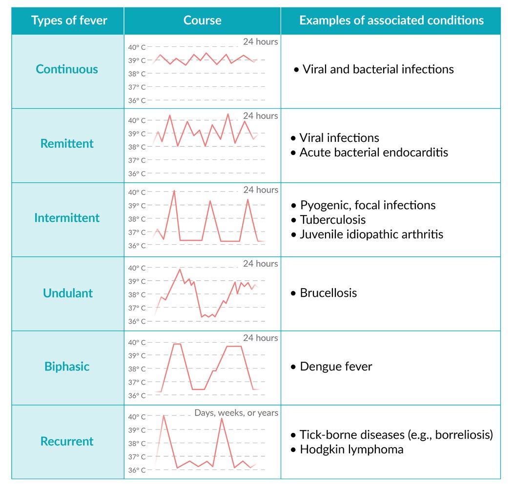 Types Of Fever Fever Wikipedia