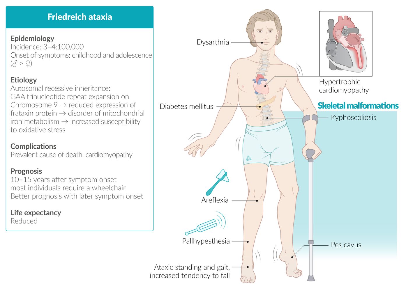Friedreich's Ataxia Symptoms