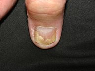 Differential diagnoses