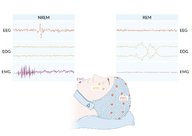 EEG patterns