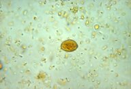 can be classified into four groups, depending on their means of movement.