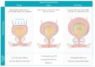 Overview of pharmacotherapy