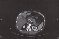 Perform further diagnostics as needed to determine the etiology