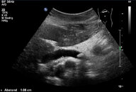 CT scan with IV contrast [11] [12] [13]