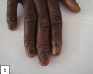 Differential diagnoses