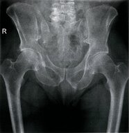 Additional diagnostics [5] [8]