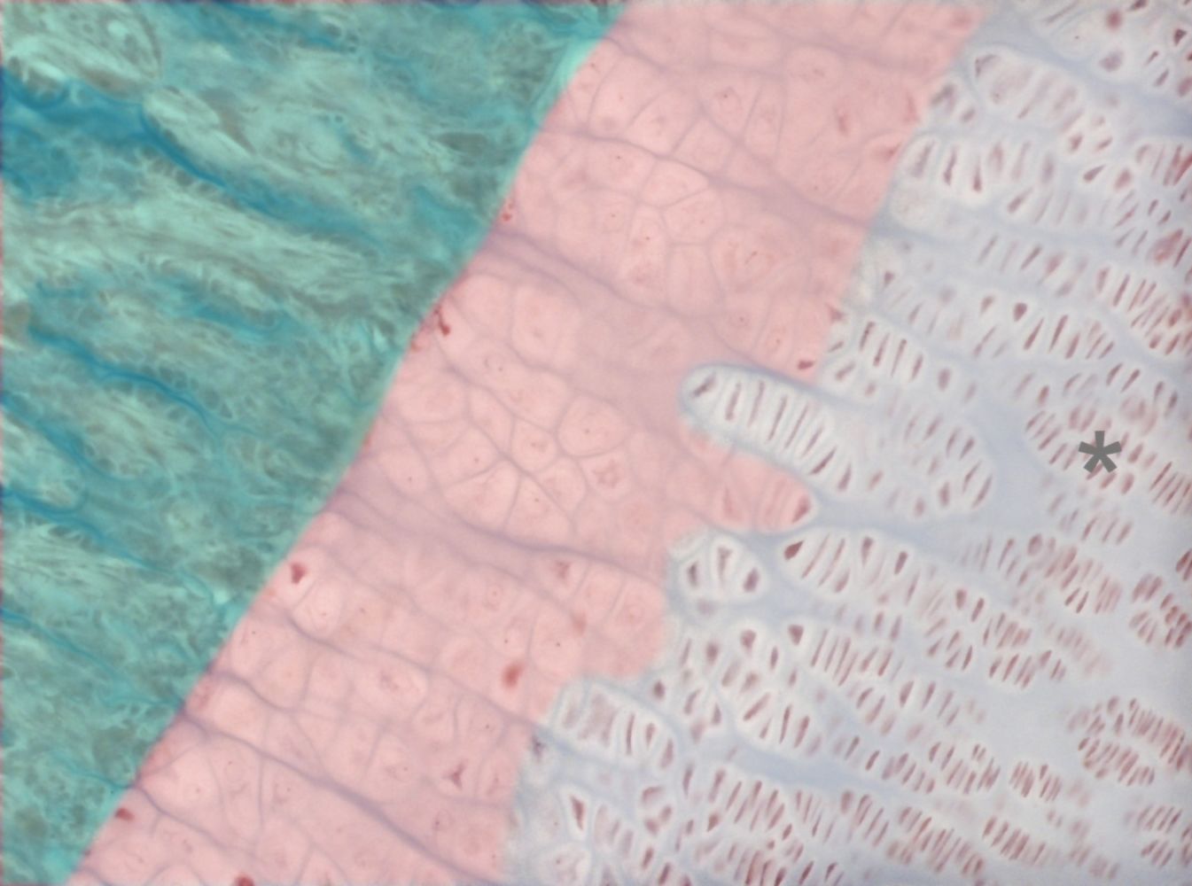 Bone Cells Microscope Labeled