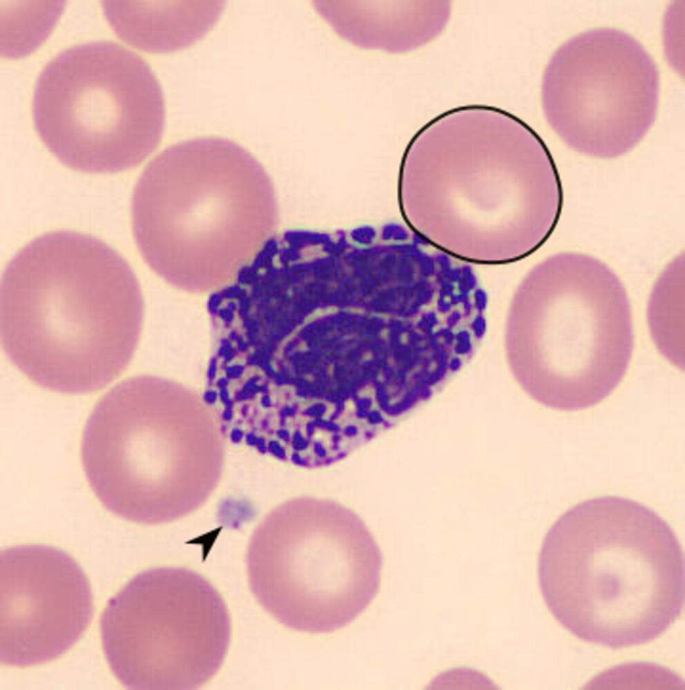 Hematology Part 2 White Blood Cells